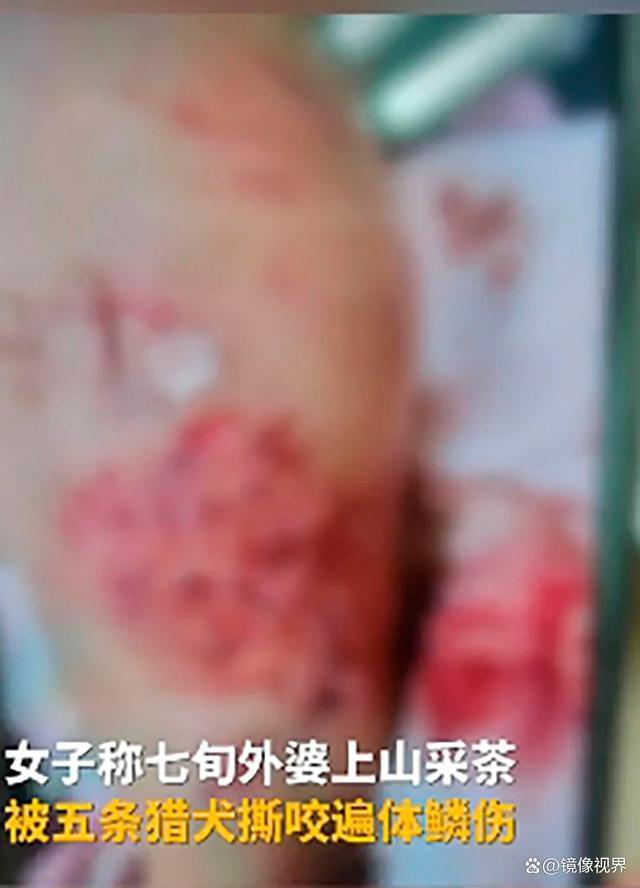文章图片