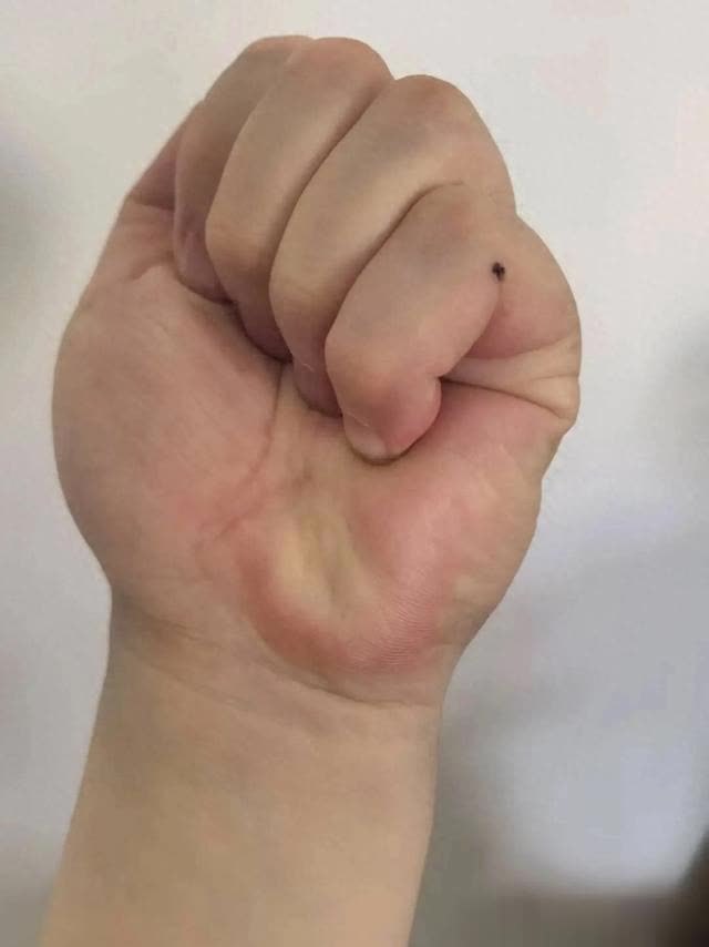文章图片