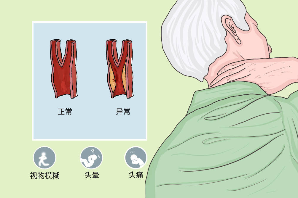 文章图片